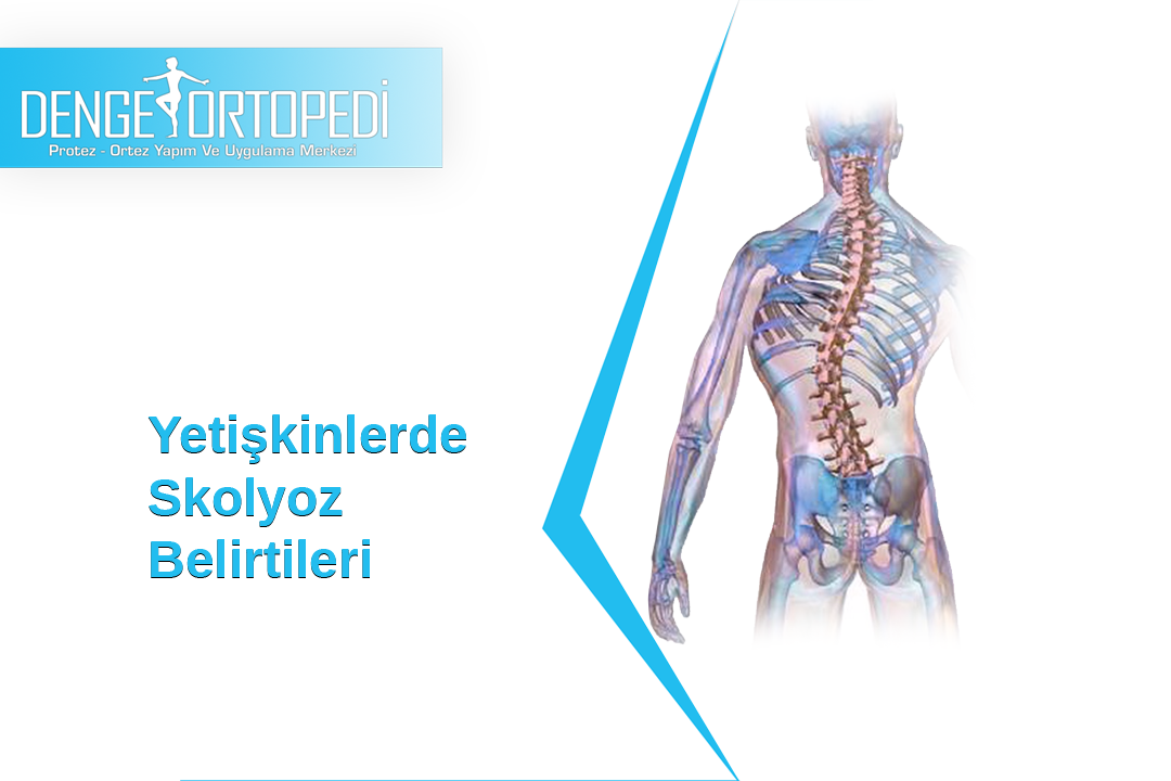 Yetişkinlerde Skolyoz Belirtileri - DENGE ORTOPEDİ